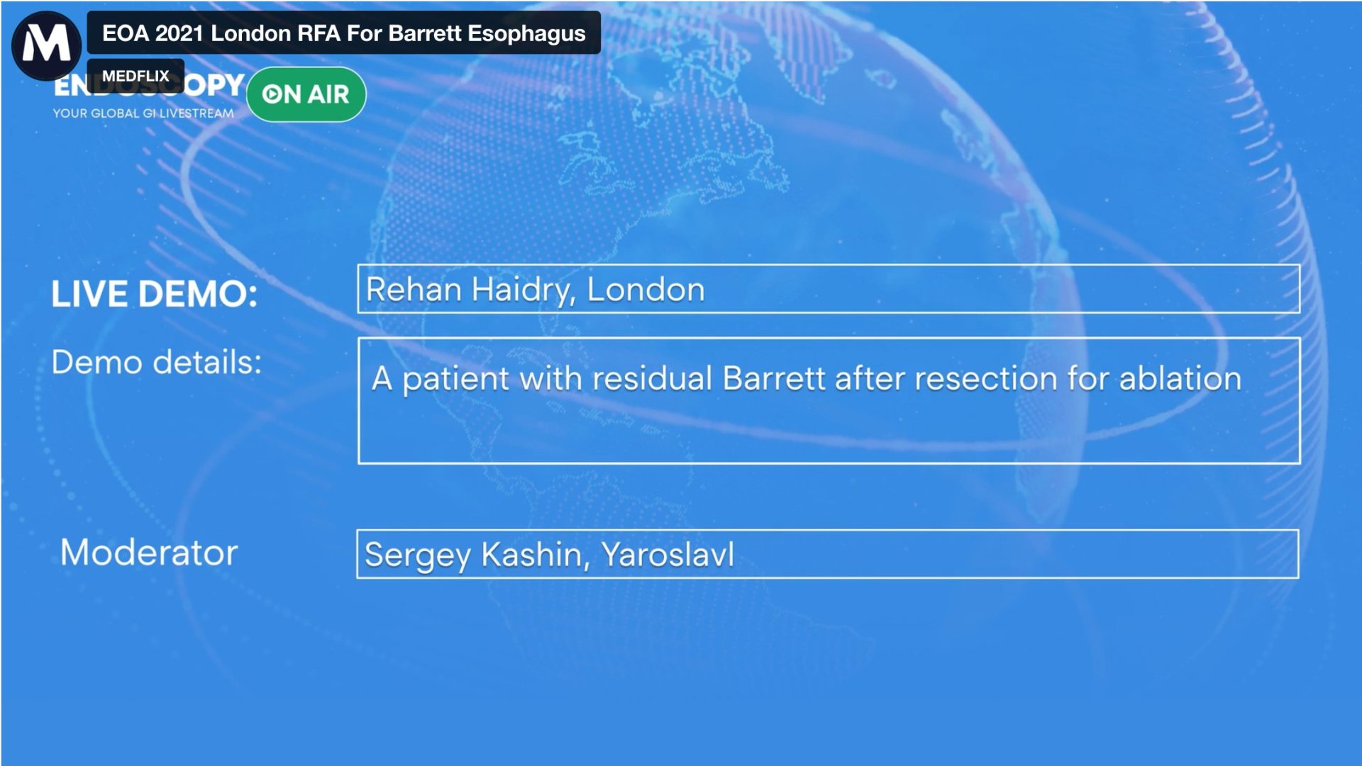 Live Demo: London RFA For Barrett Esophagus - Endoscopy On Air