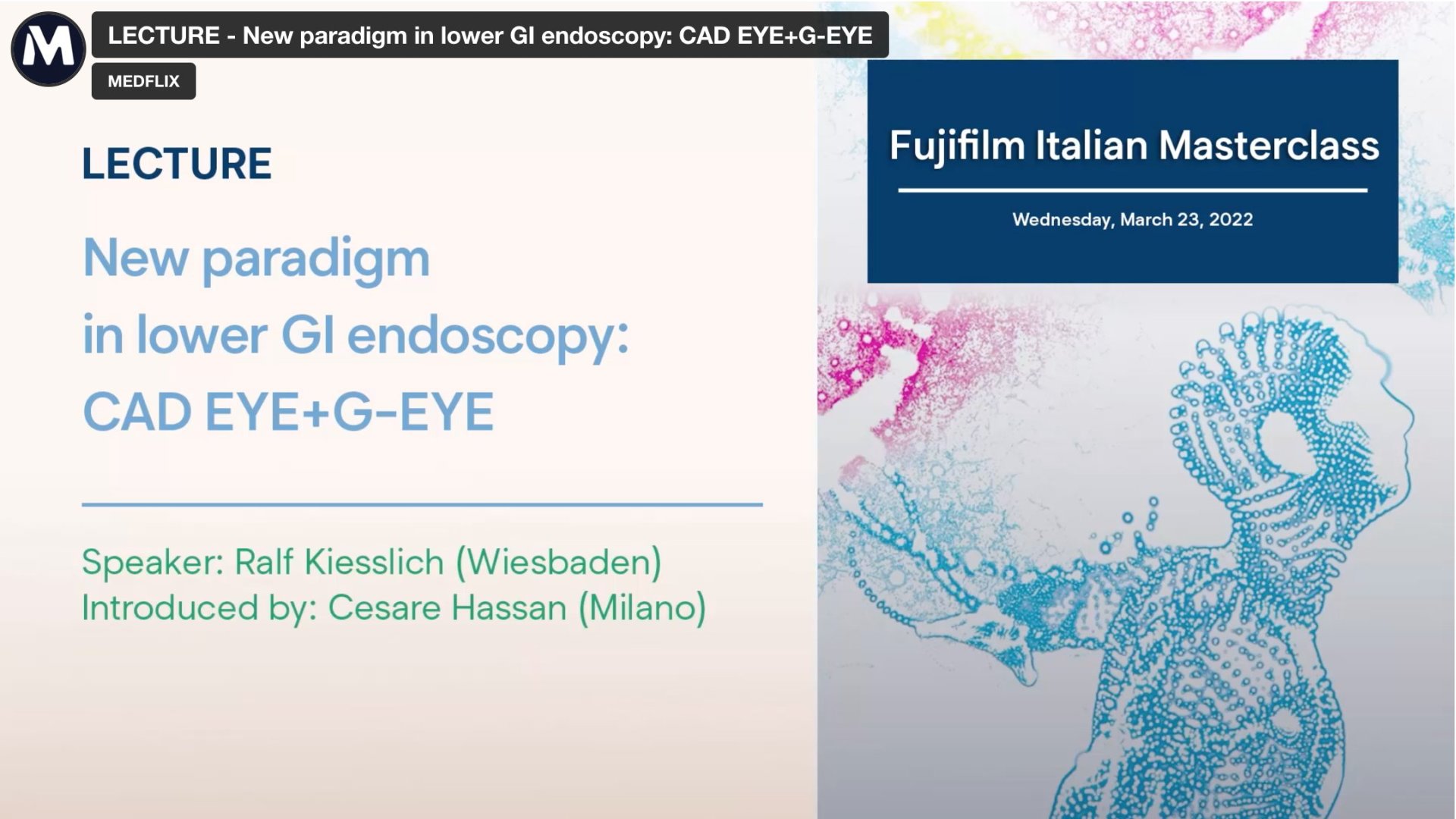 Lecture - New paradigm in lower GI endoscopy: CAD EYE+G-EYE - Endoscopy ...