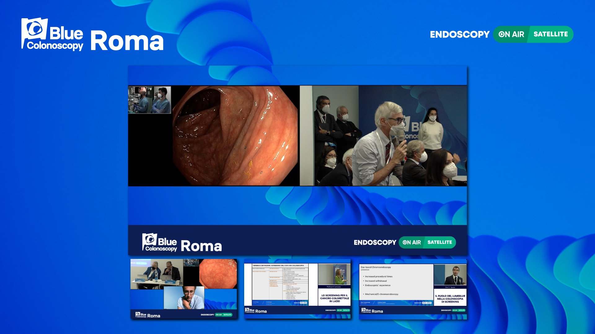 Blue Colonoscopy - Roma - Endoscopy On Air