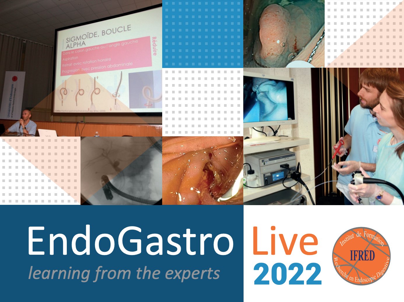 EndoGastroLive 2022 - ESD Event: Tips and tricks for ESD with focus on ...