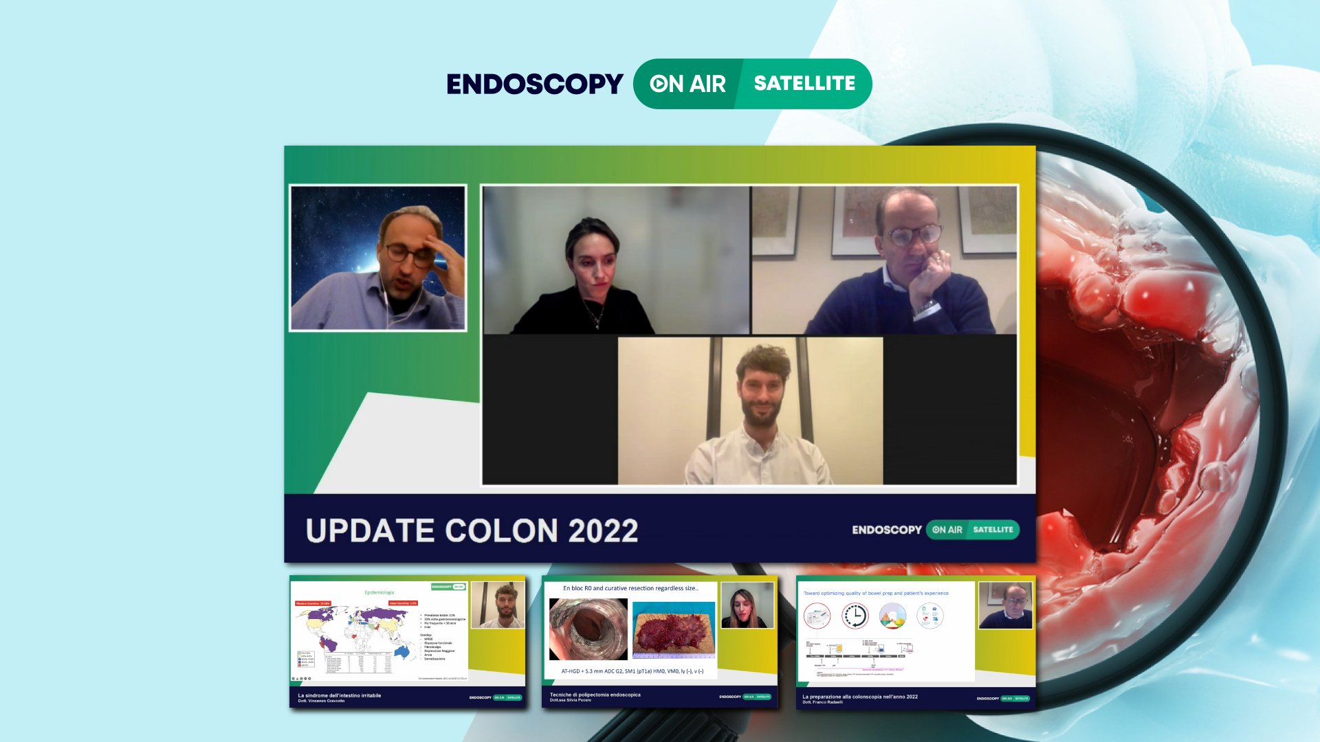 Update Colon 2022 - Endoscopy On Air