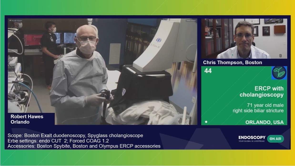 ERCP with cholangioscopy - Endoscopy On Air