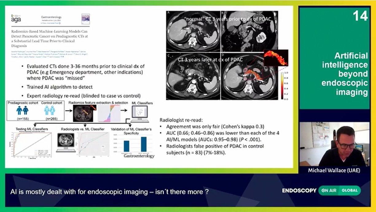 AI applications in GI beyond endoscopic imaging - Michael Wallace ...