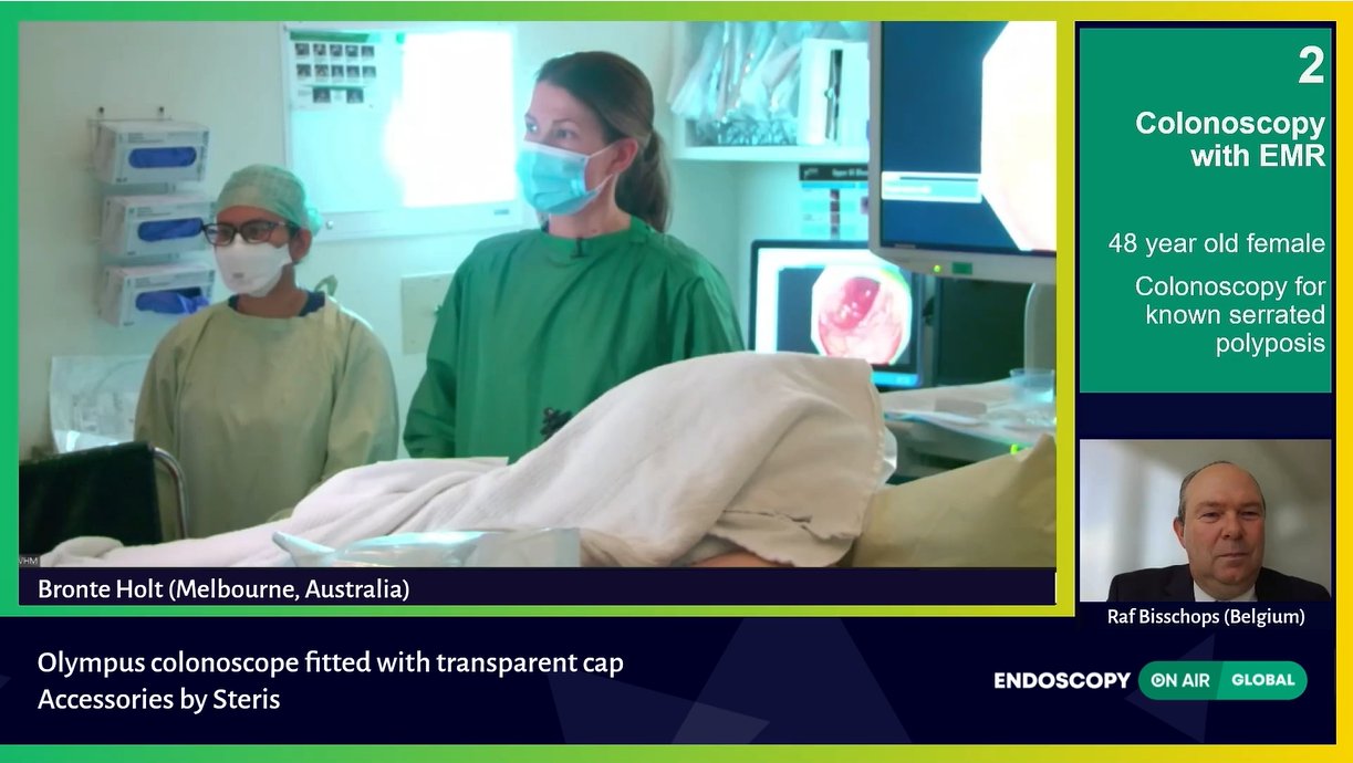 Colonoscopy with EMR - Bronte Holt - Endoscopy On Air