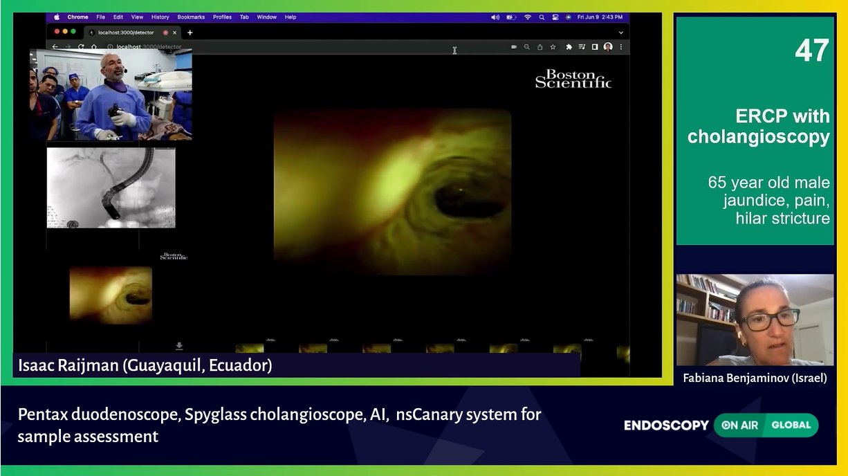 ERCP with cholangioscopy - Isaac Raijman - Endoscopy On Air