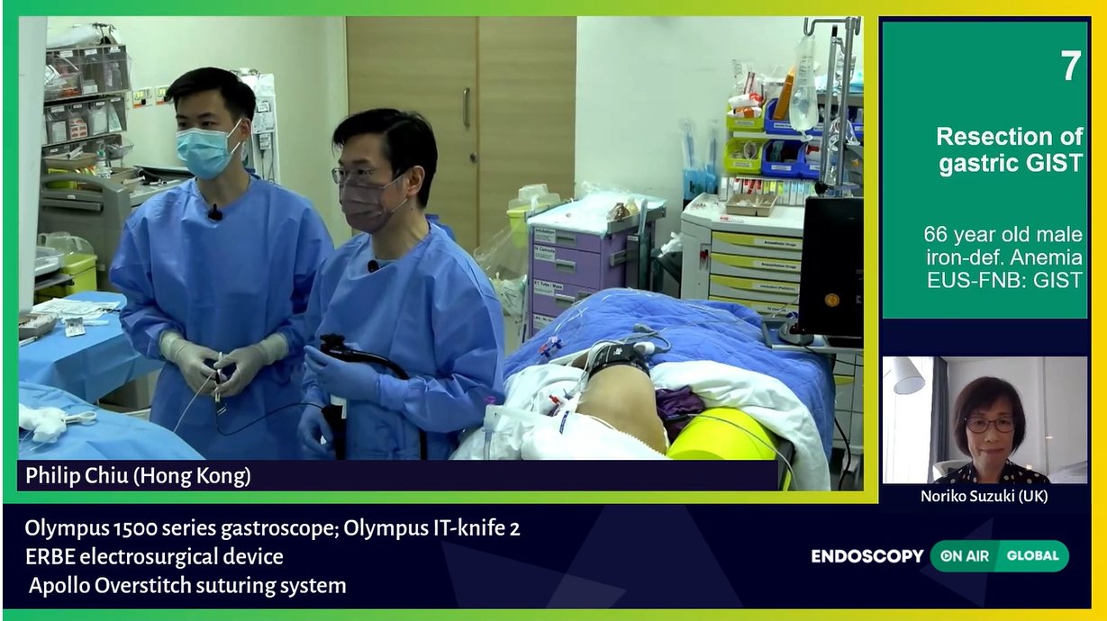Resection of gastric GIST - Philip Chiu - Endoscopy On Air