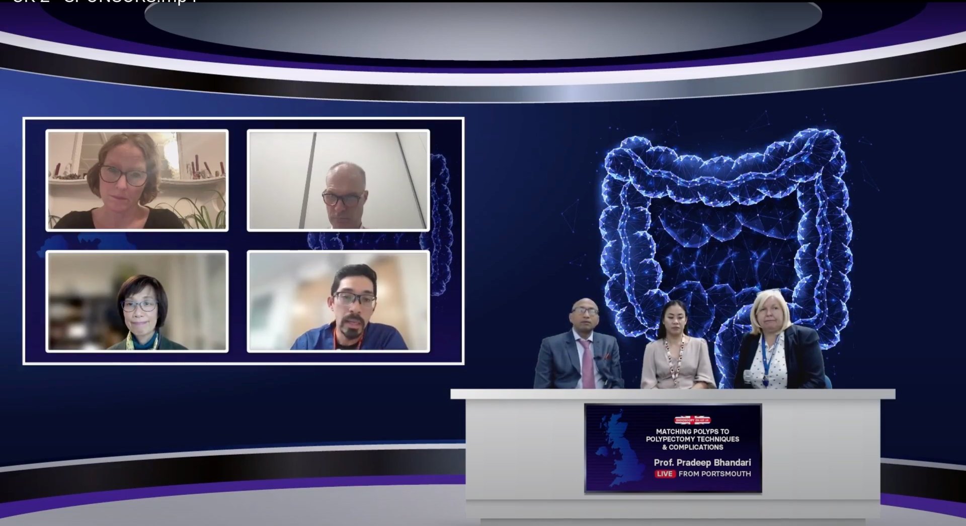 Endoscopy On Air Uk Advancing The Polyp Resection Practice