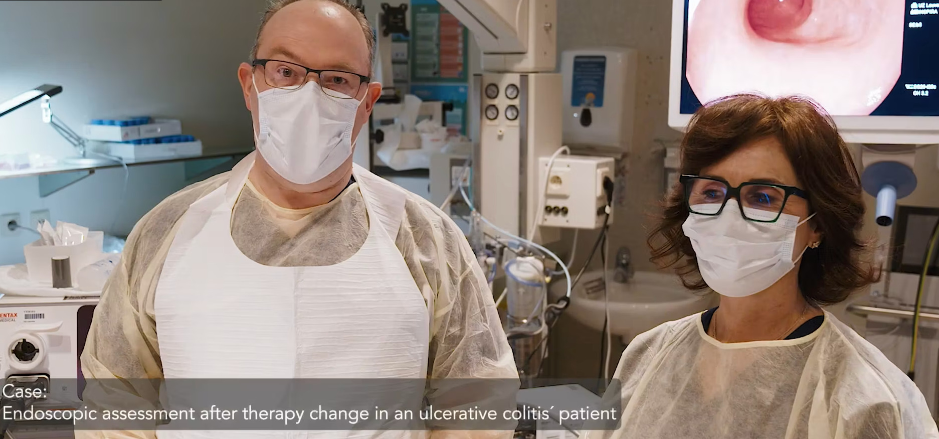 Endoscopic Assessment after Therapy Change in an Ulcerative Colitis ...