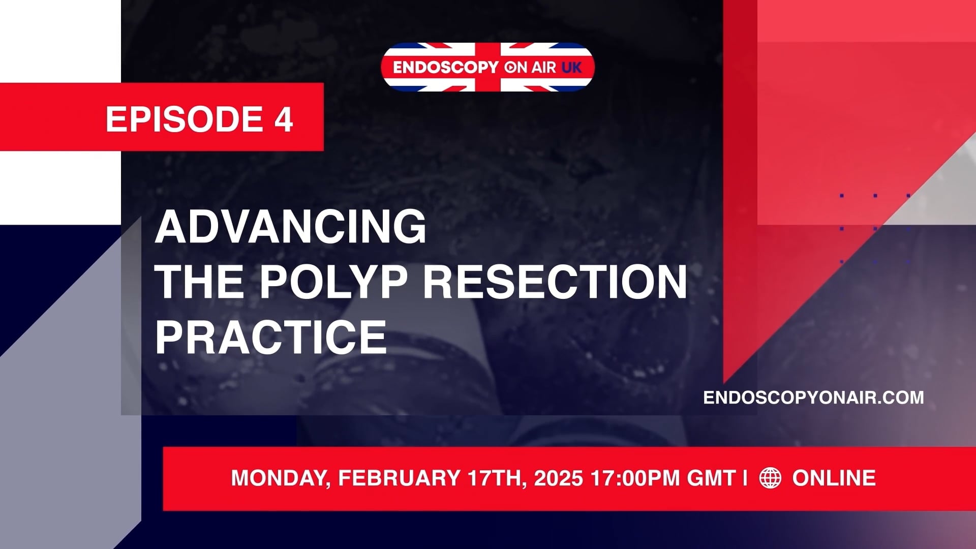 Advancing the Polyp Resection Practice - Endoscopy On Air