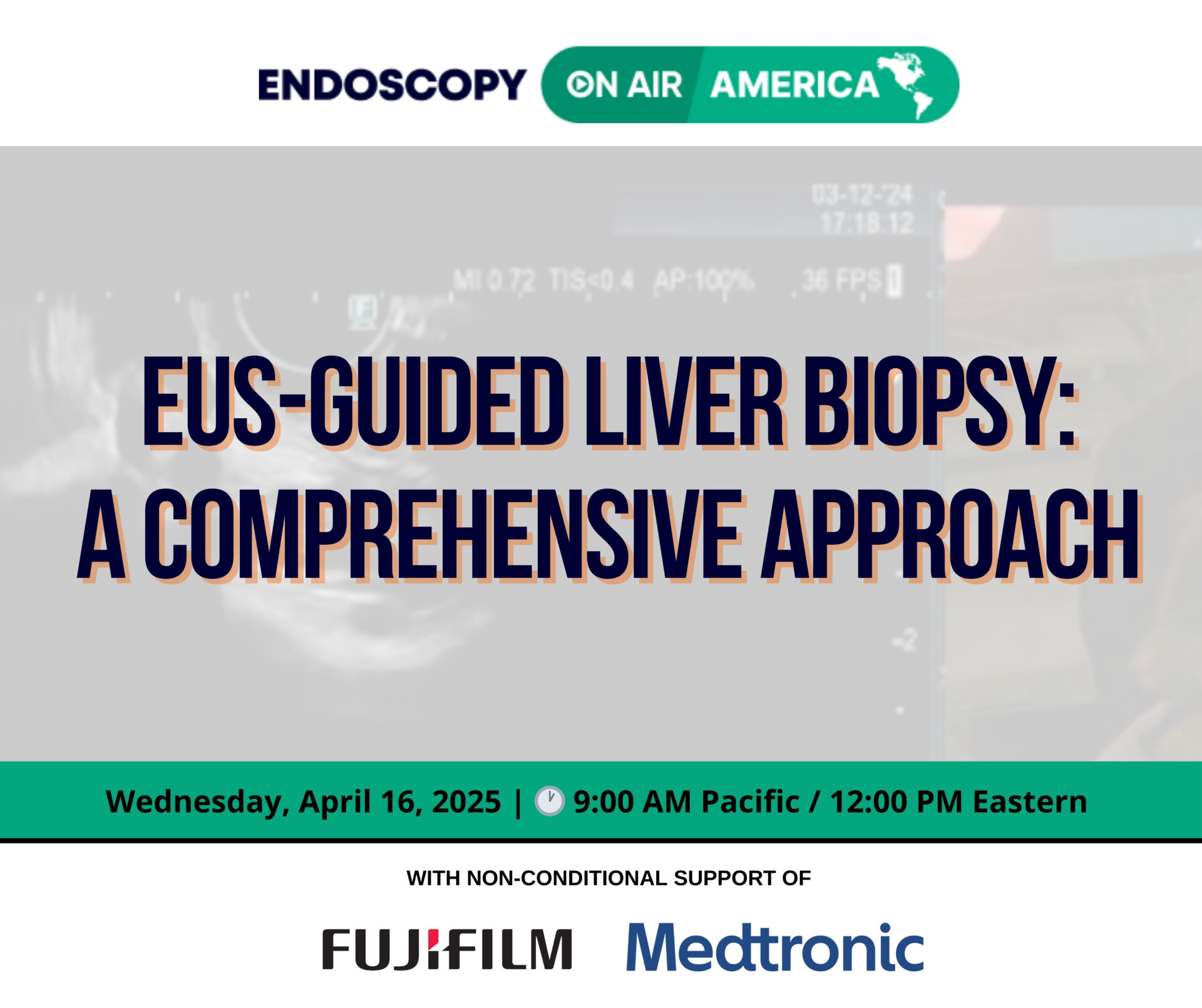 EUS-Guided Liver Biopsy: A Comprehensive Approach - Endoscopy On Air