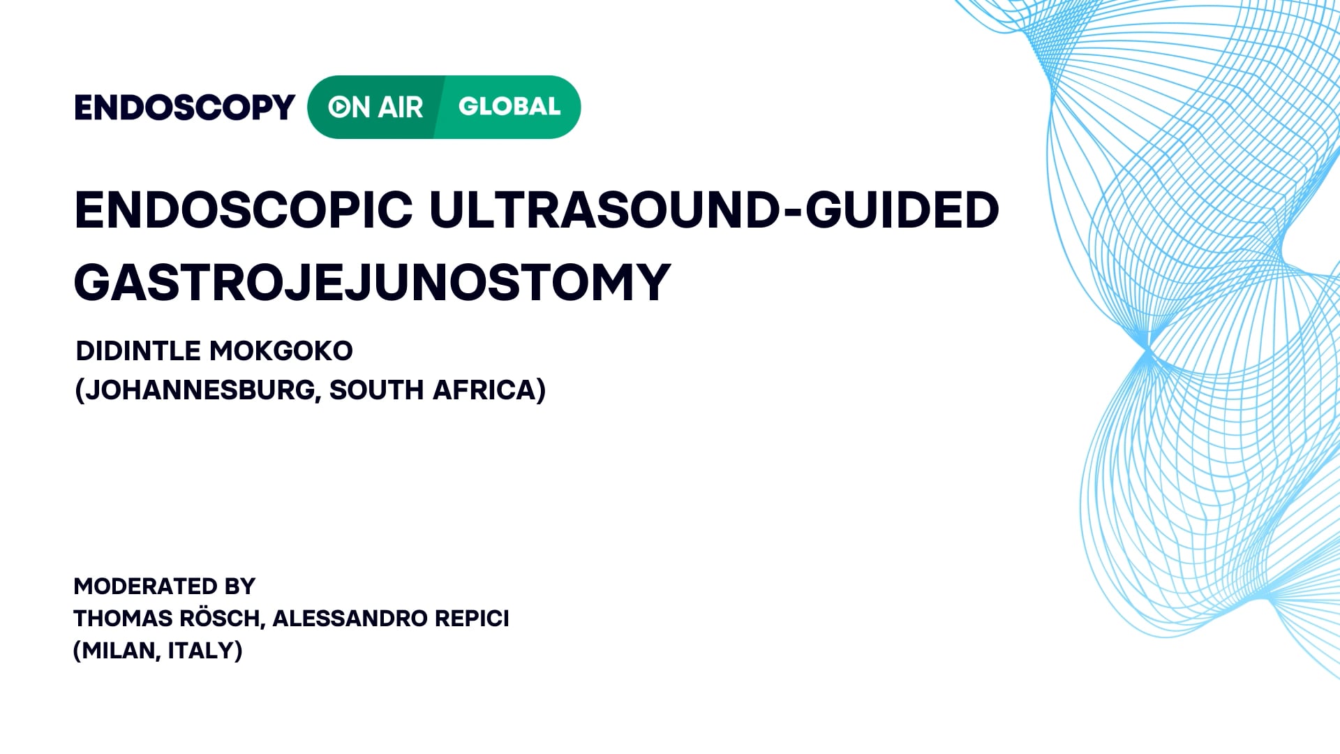EUS guided gastroenteroanastomosis - Endoscopy On Air